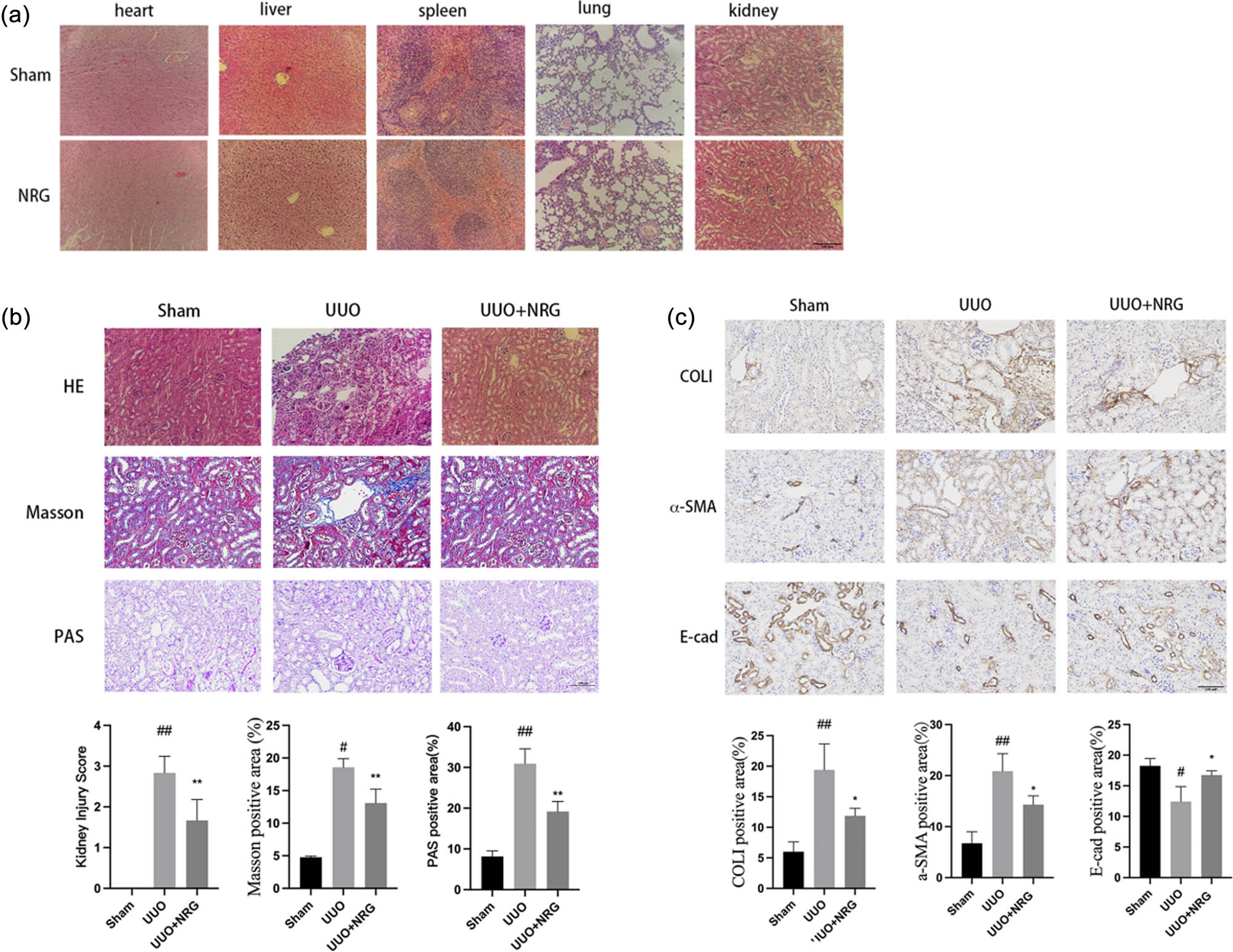 Network pharmacology combined with molecular docking and experimental ...
