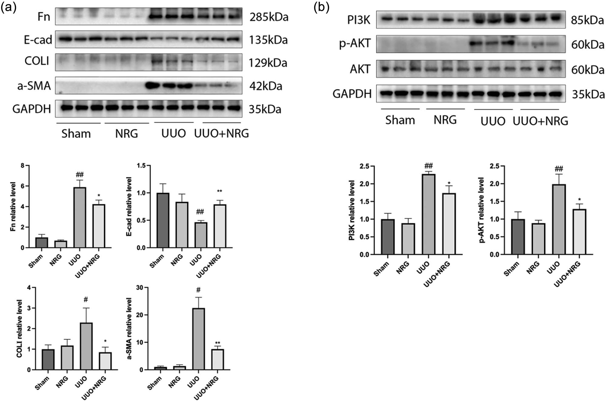 Network pharmacology combined with molecular docking and experimental ...