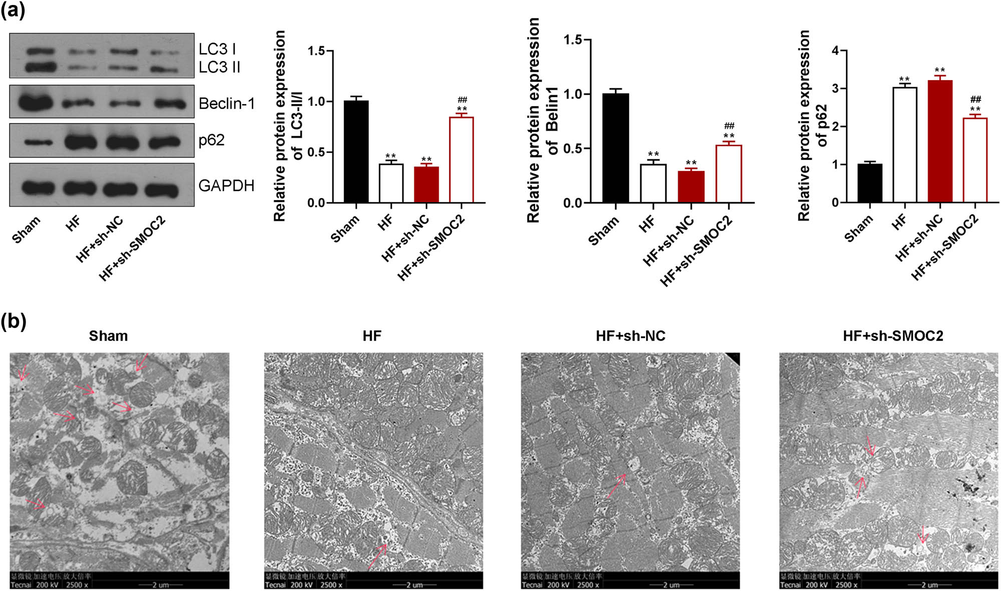 SMOC2 plays a role in heart failure via regulating TGF-β1/Smad3 pathway ...