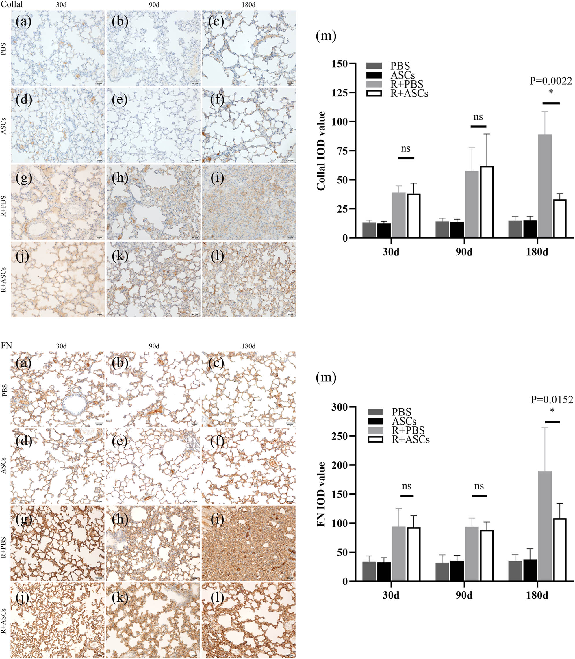 Adipose-derived stem cells repair radiation-induced chronic lung injury ...