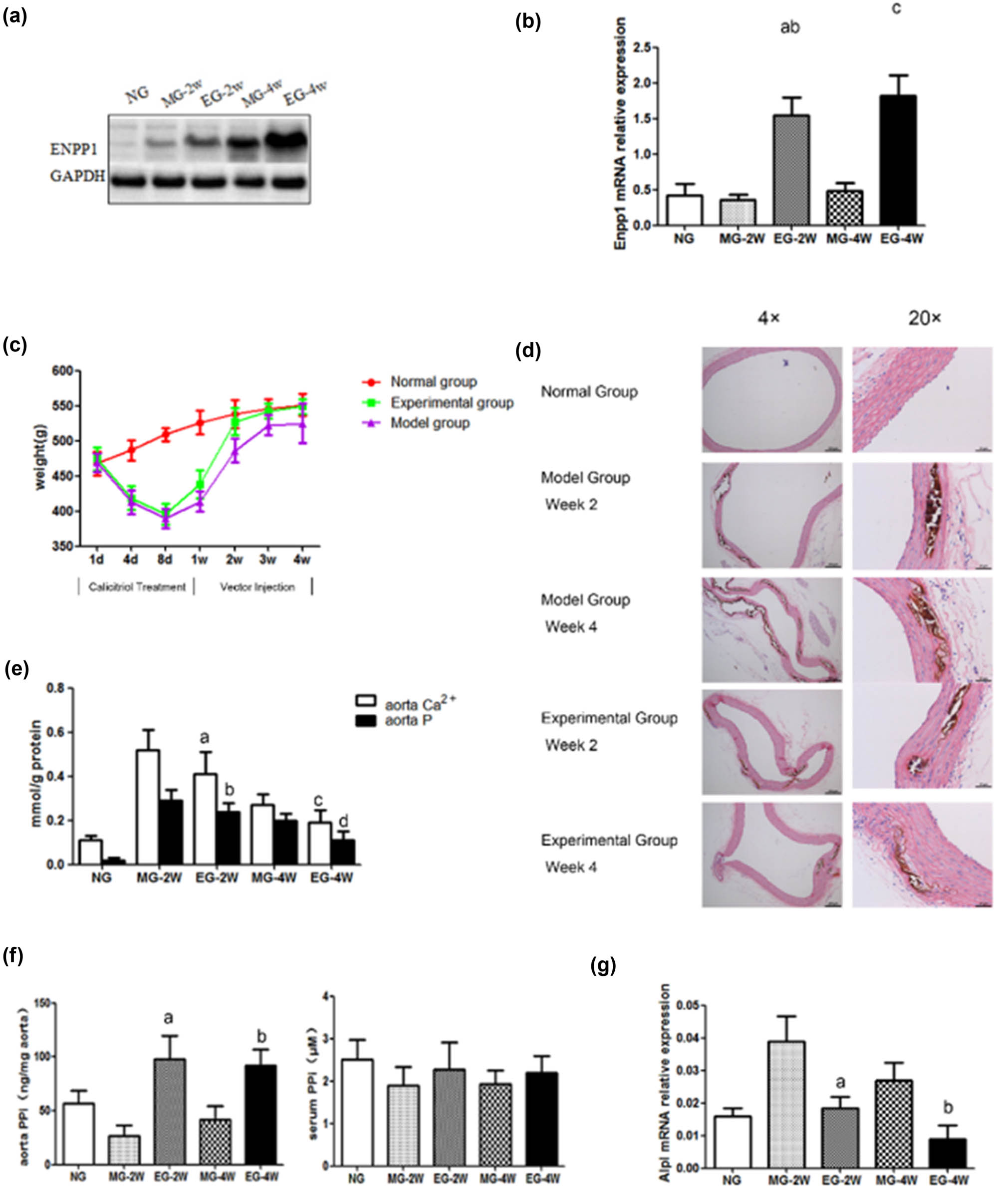 ENPP1 ameliorates vascular calcification via inhibiting t...