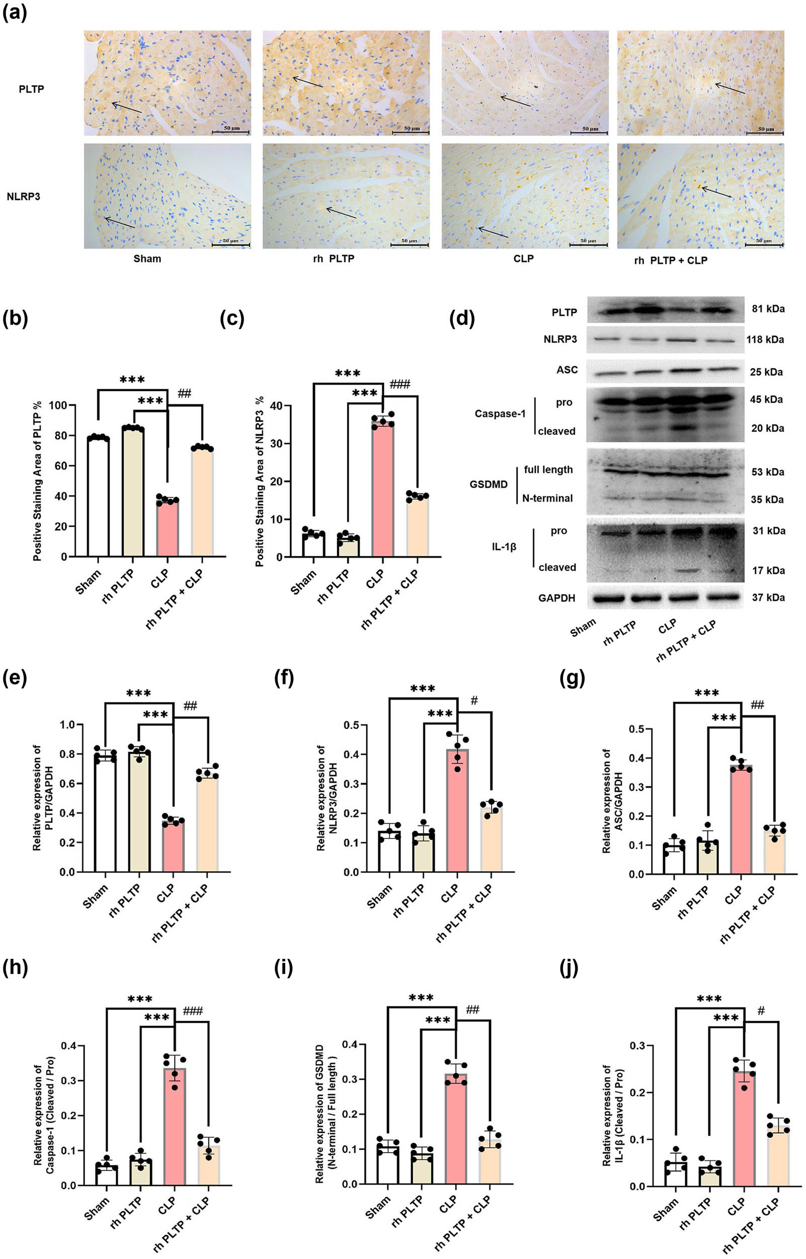 Phospholipid transfer protein ameliorates sepsis-induced cardiac ...