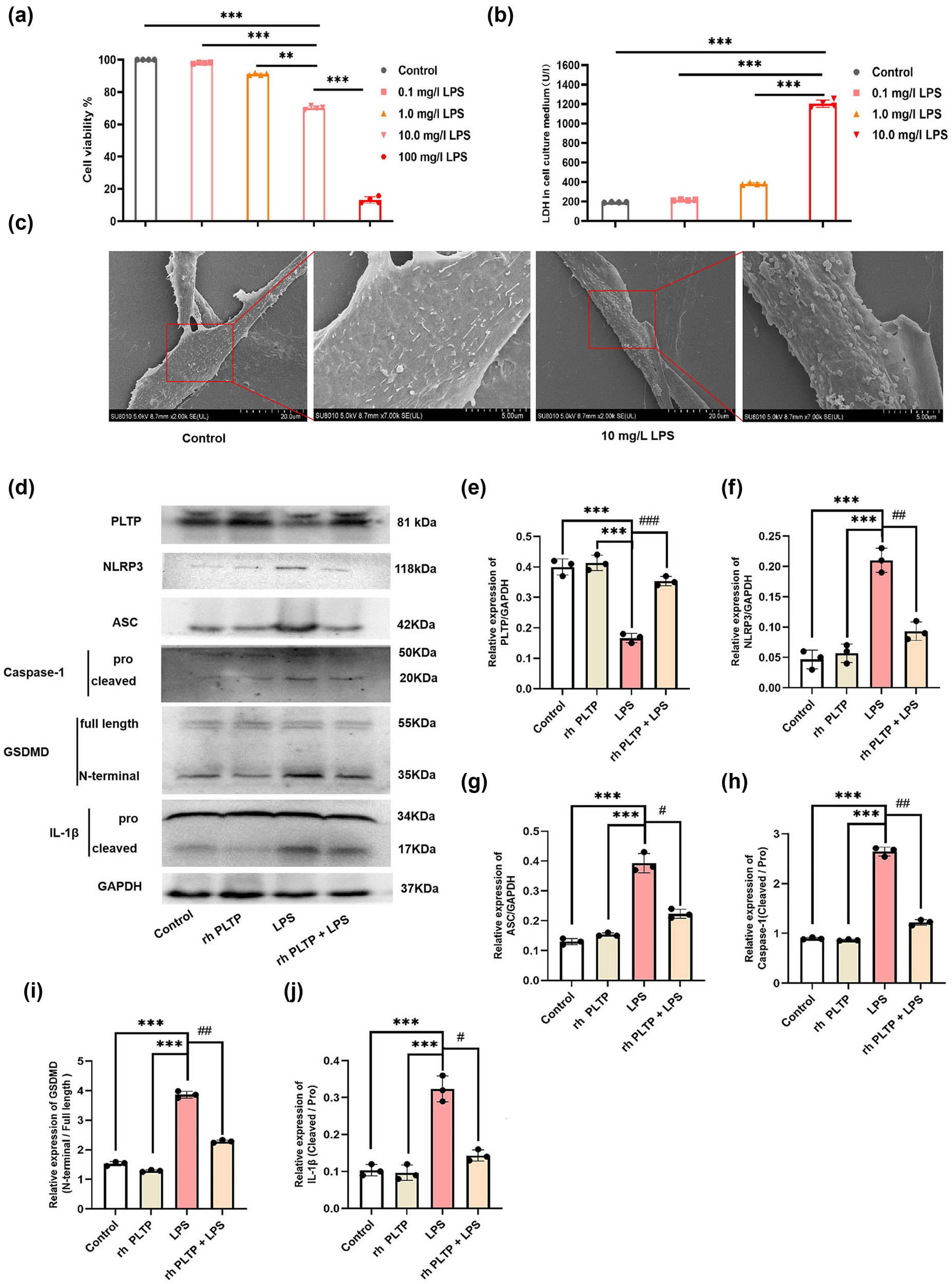Phospholipid transfer protein ameliorates sepsis-induced cardiac ...