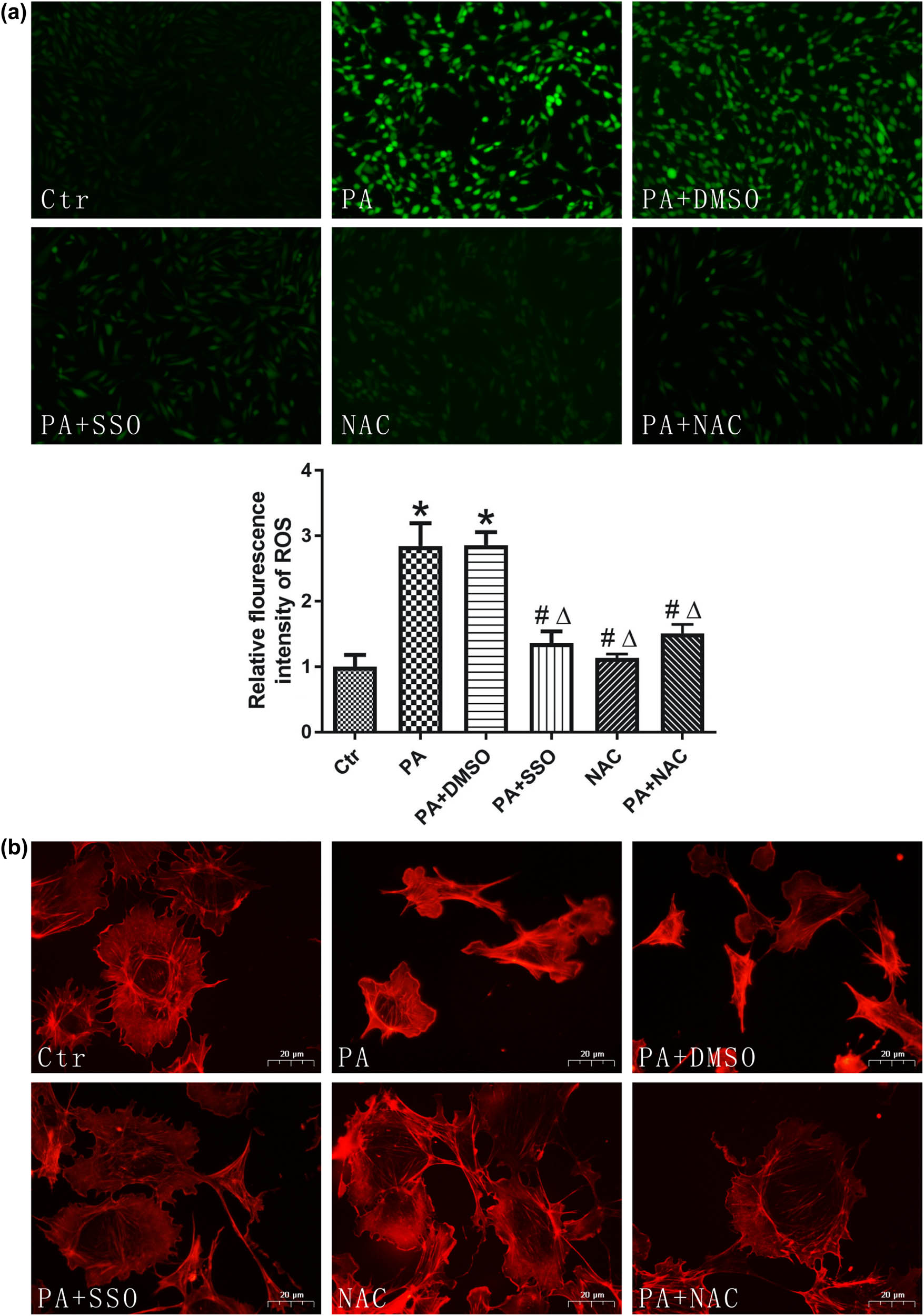 CD36-mediated podocyte lipotoxicity promotes foot process effacement