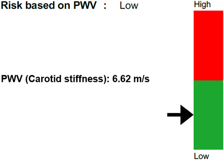 Early detection of cardiovascular risk markers through non-invasive ...