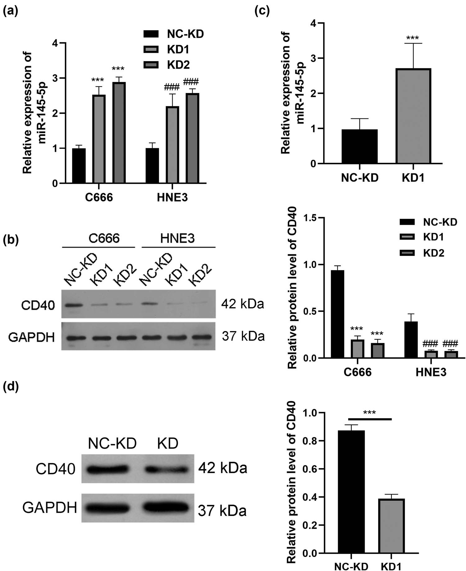 Decreased BIRC5-206 promotes epithelial–mesenchymal transition in ...