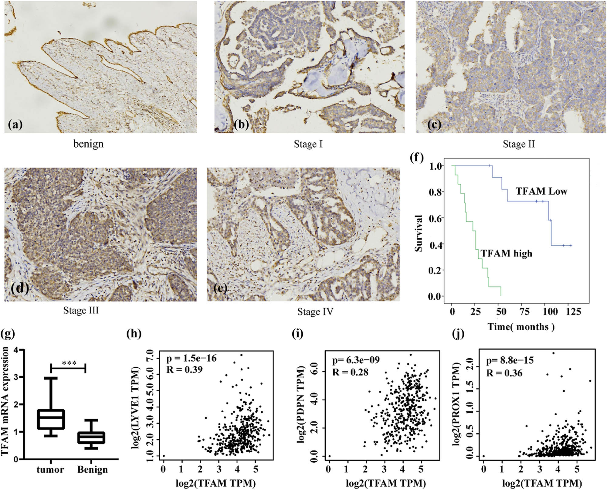Transcription factor A, mitochondrial promotes lymph node metastasis ...