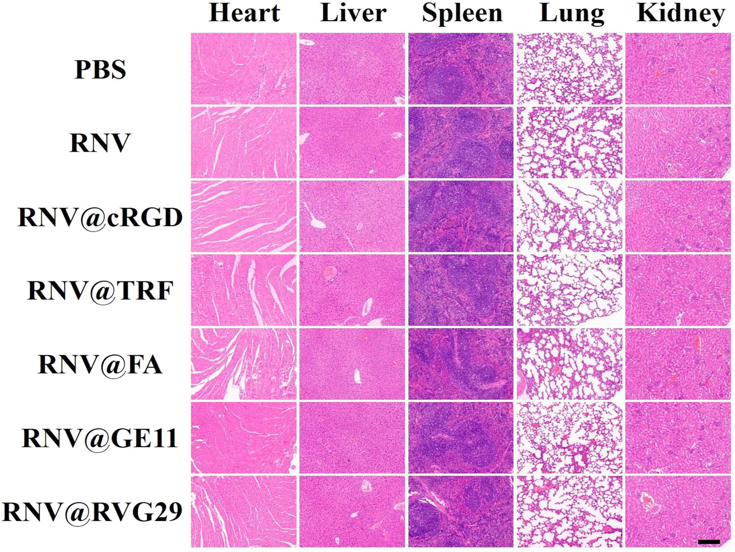Engineered RBC-derived nanovesicles functionalized with t...