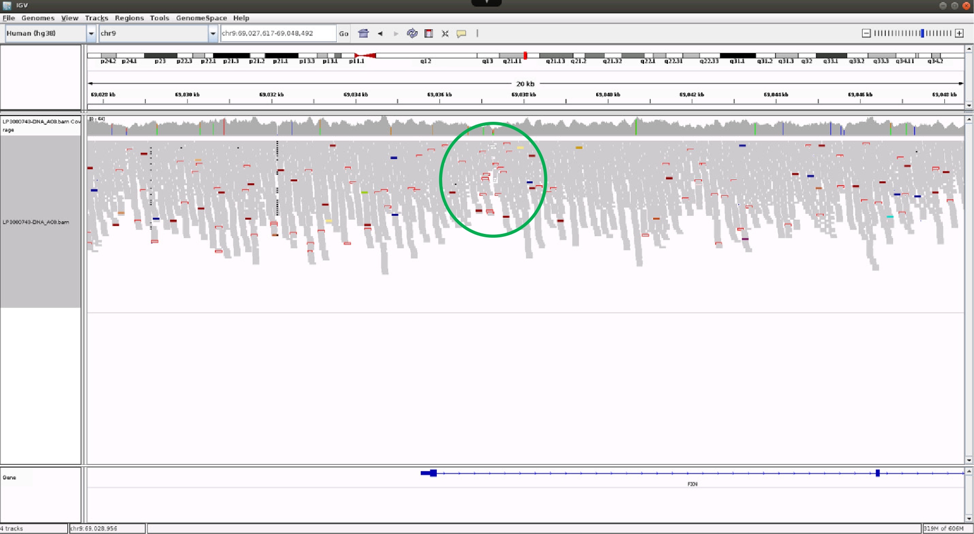 Advancing Charcot-Marie-Tooth disease diagnostics, throug...