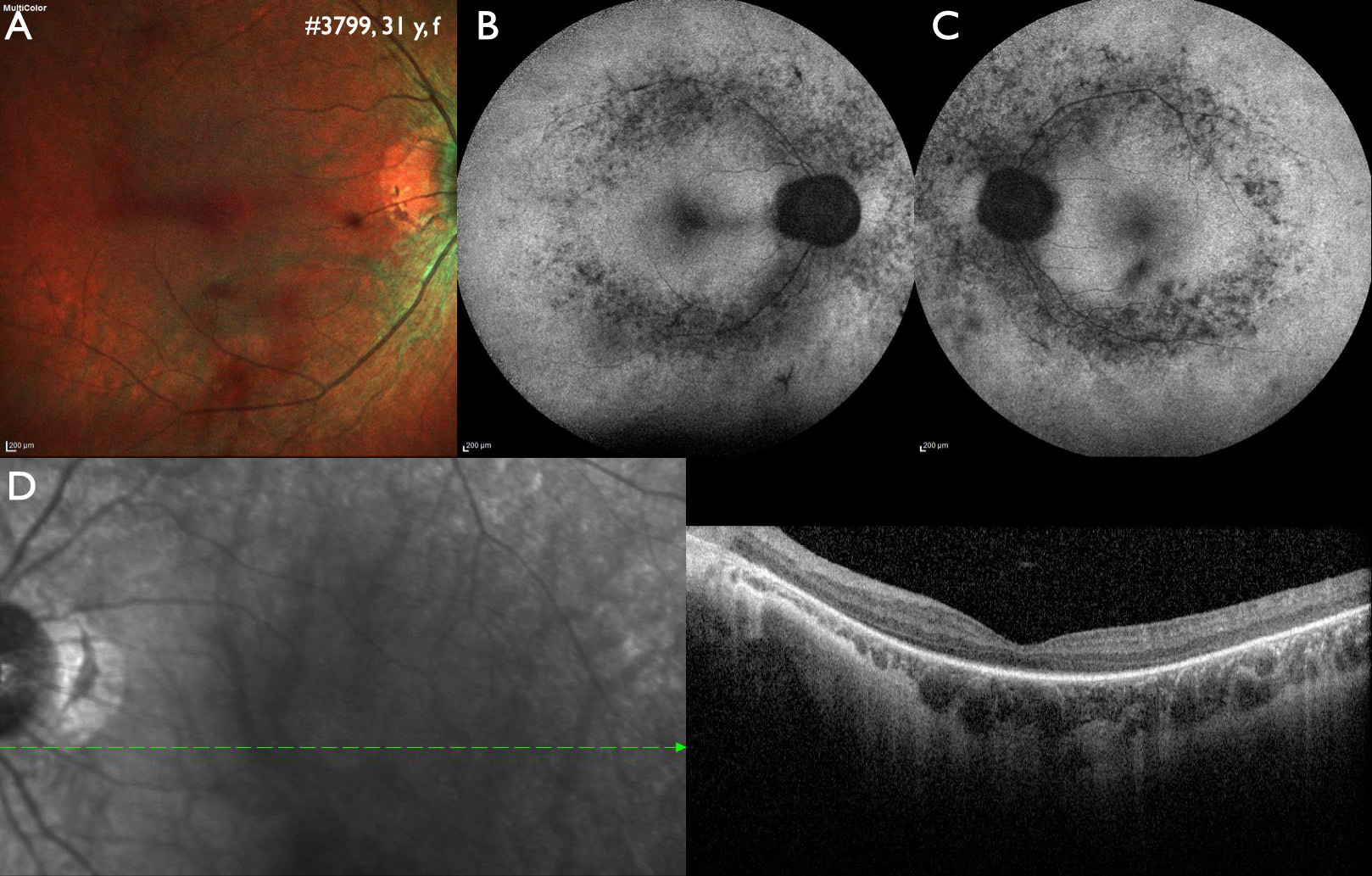 The value of genetic testing in pediatric and adult ophthalmology