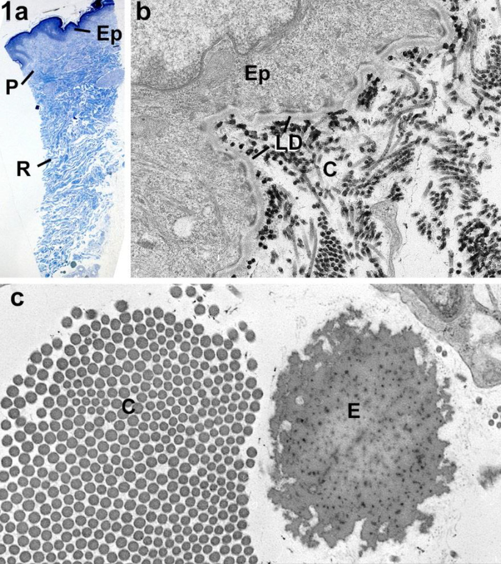 Non-genetic diagnostic investigations in monogenic Ehlers...