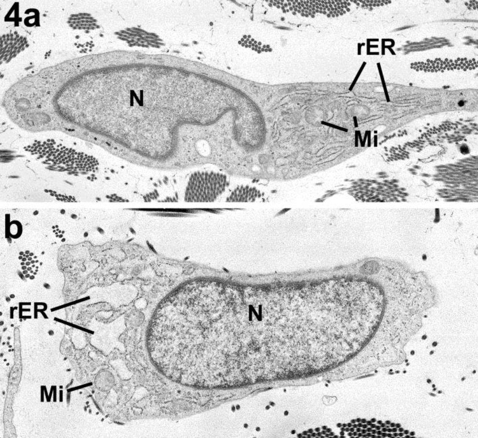 Non-genetic diagnostic investigations in monogenic Ehlers...