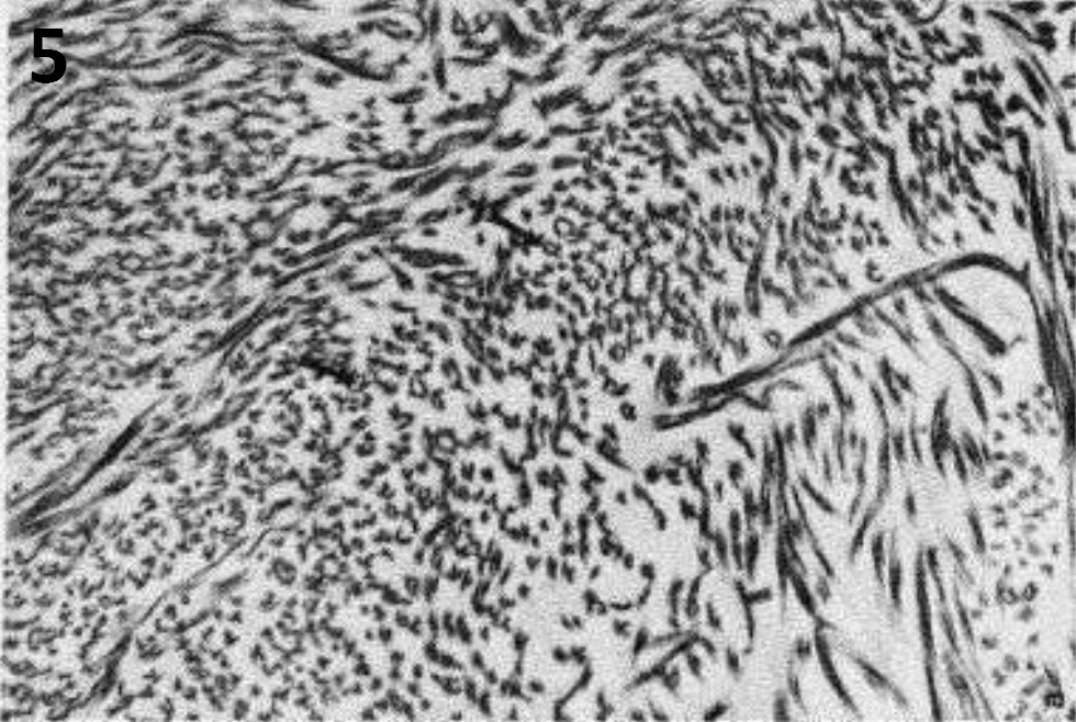 Non-genetic diagnostic investigations in monogenic Ehlers...