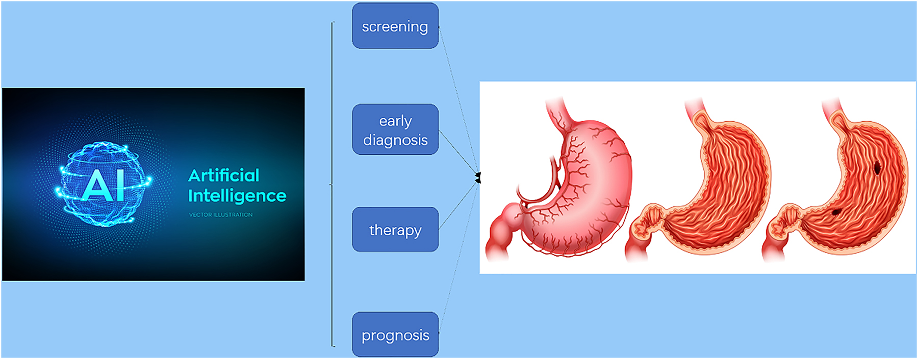 Artificial intelligence in theranostics of gastric cancer, a review