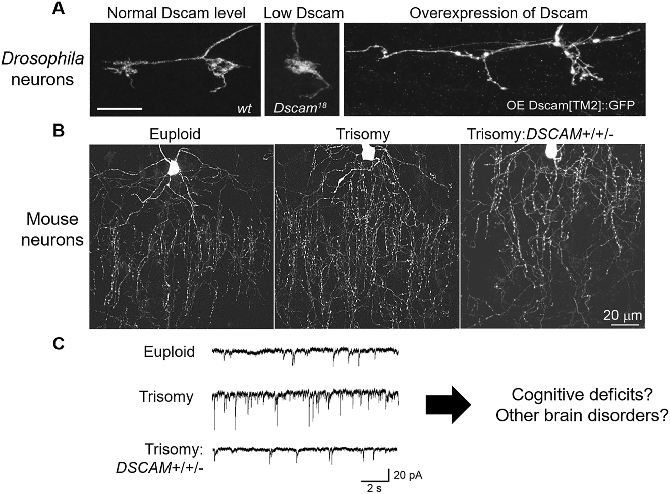 The role of Down syndrome cell adhesion molecule in Down syndrome