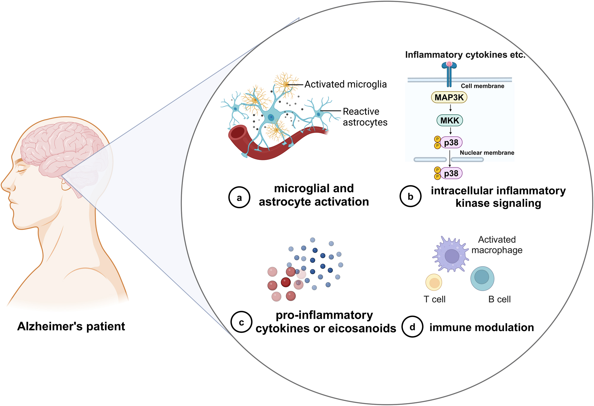 Immune cells in Alzheimer’s disease: insights into pathogenesis and potential therapeutic targets