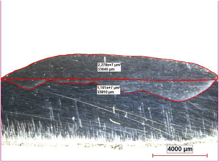 Effect of sandblasting and aging on structural and mechanical ...