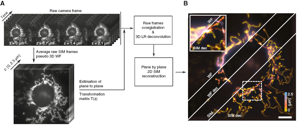 High-speed multiplane structured illumination microscopy of living ...