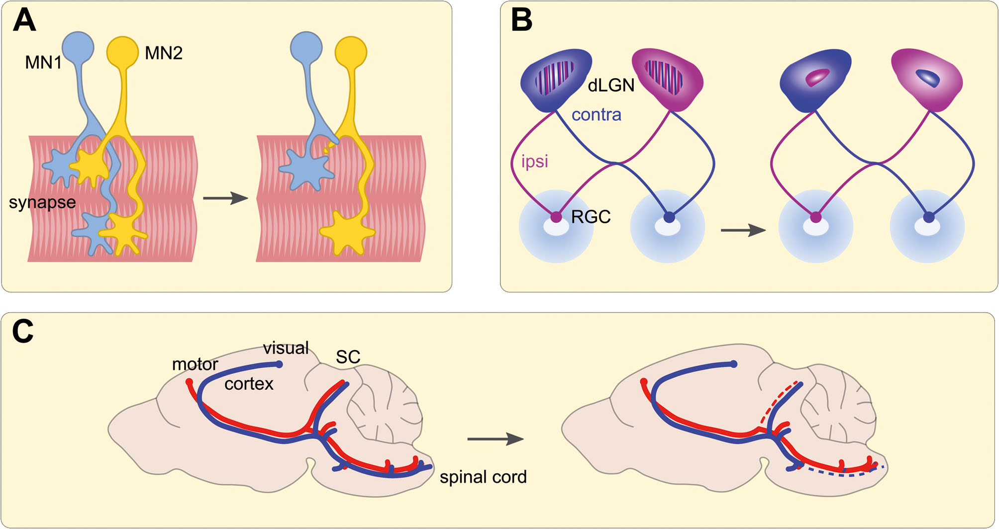 Mechanisms of Neurite Pruning