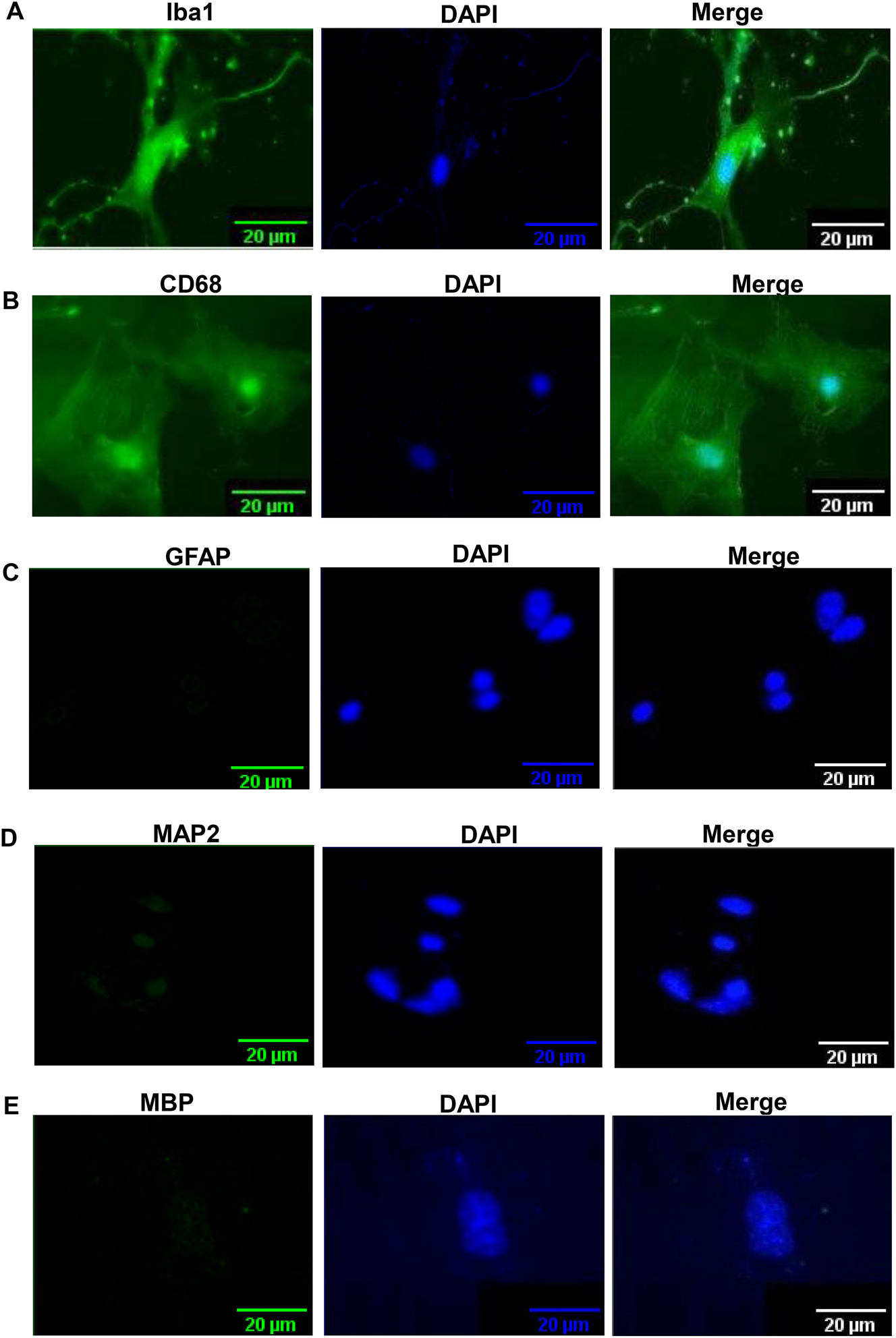 A simple protocol for isolating microglia from adult mous...