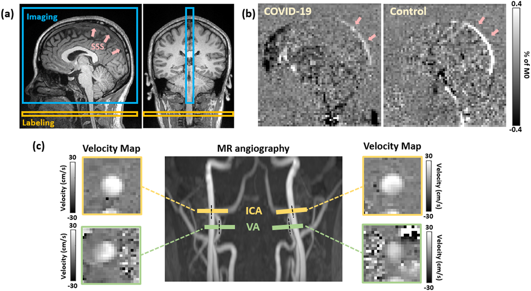 Blood-brain barrier breakdown in COVID-19 ICU survivors: an MRI pilot study