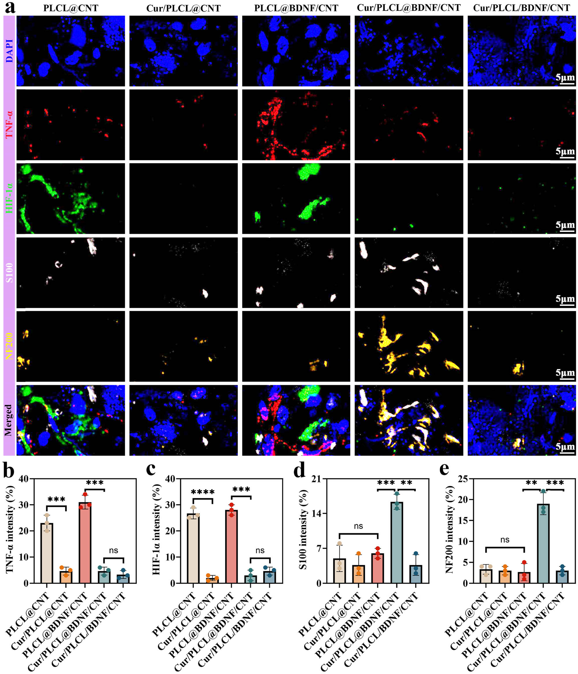 Shell-core-structured electrospinning film with sequential anti ...