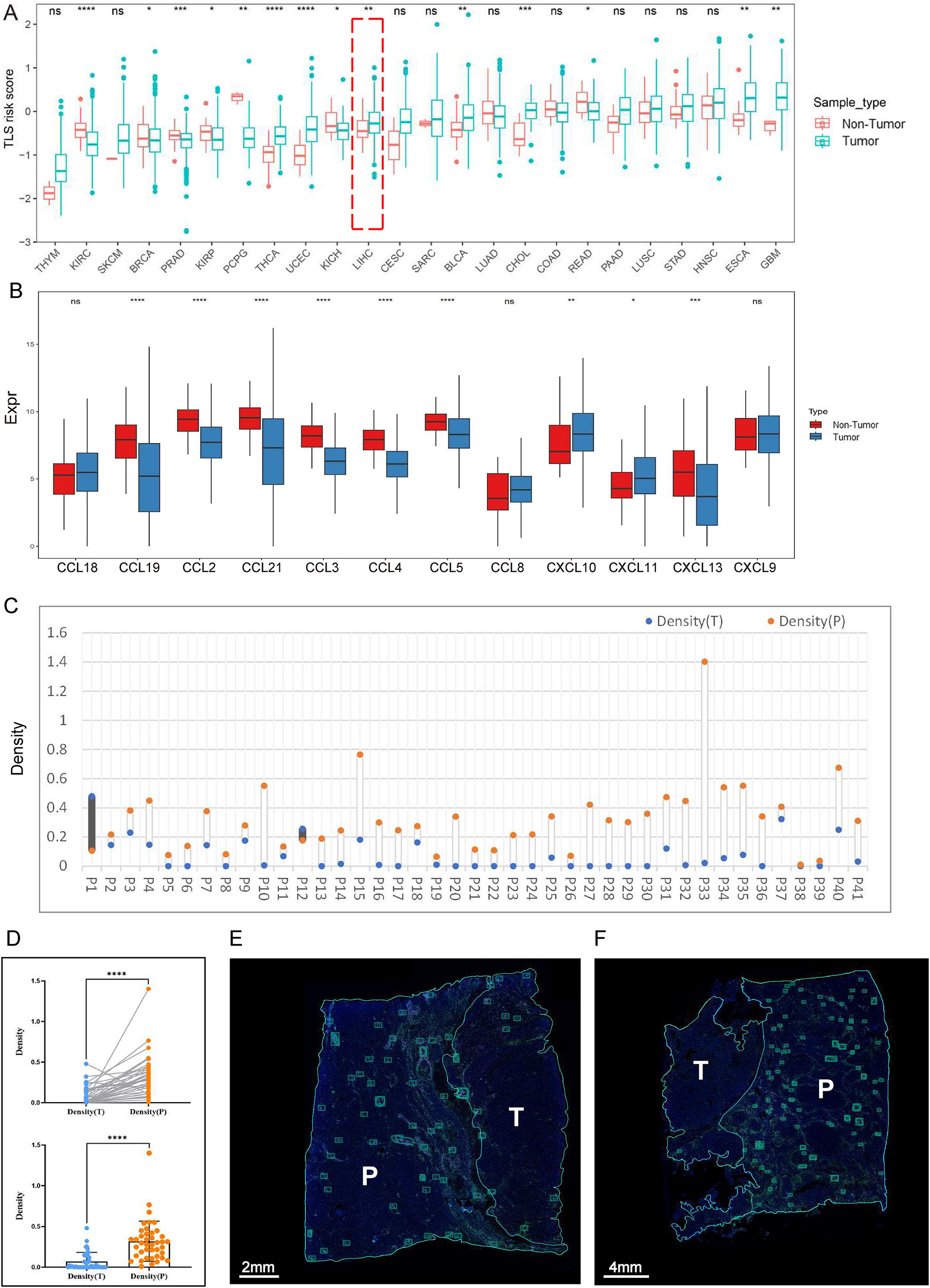 Transcriptome analysis of tertiary lymphoid structures (TLSs)-related ...