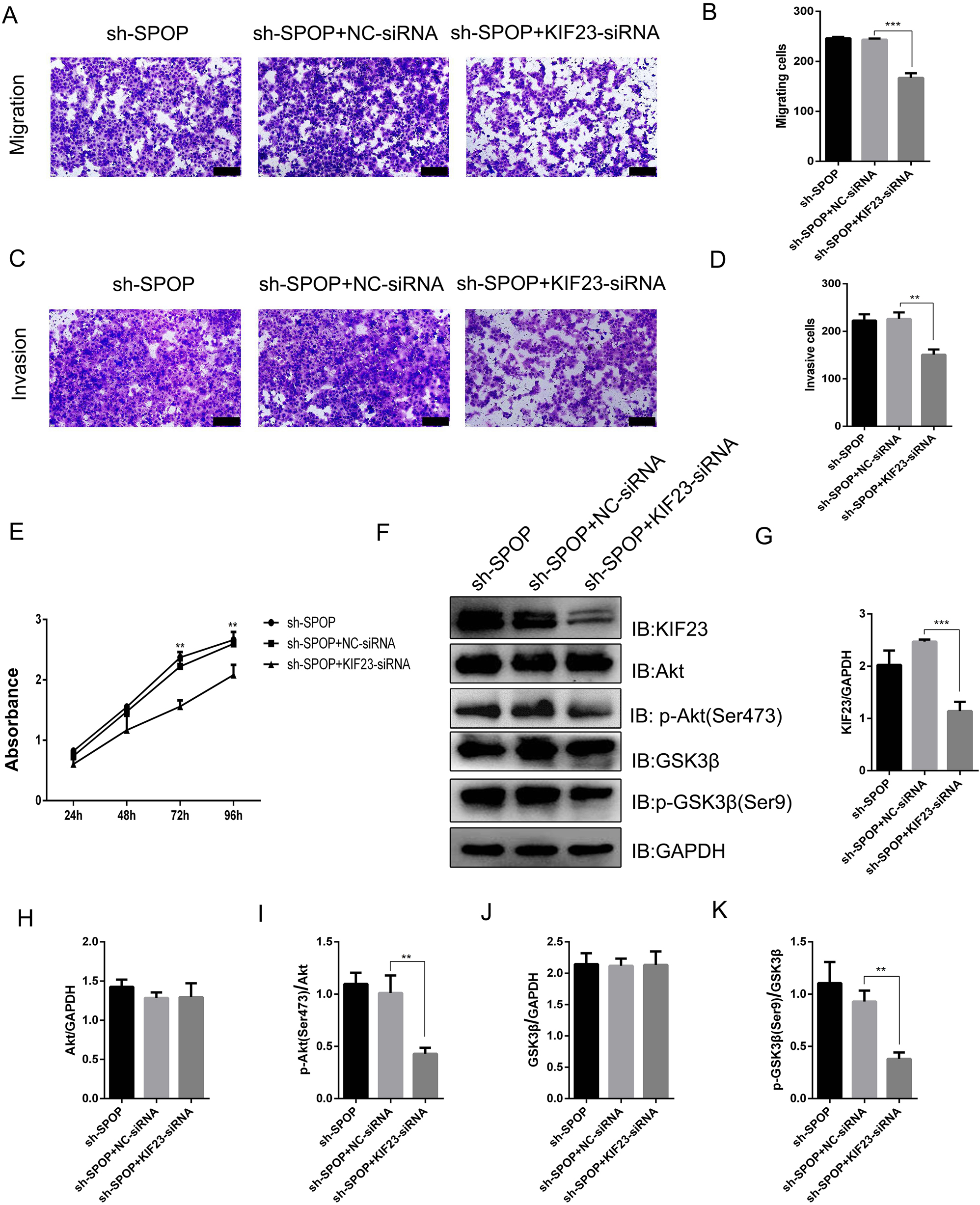 SPOP attenuates the proliferation, invasion, and migration of ...