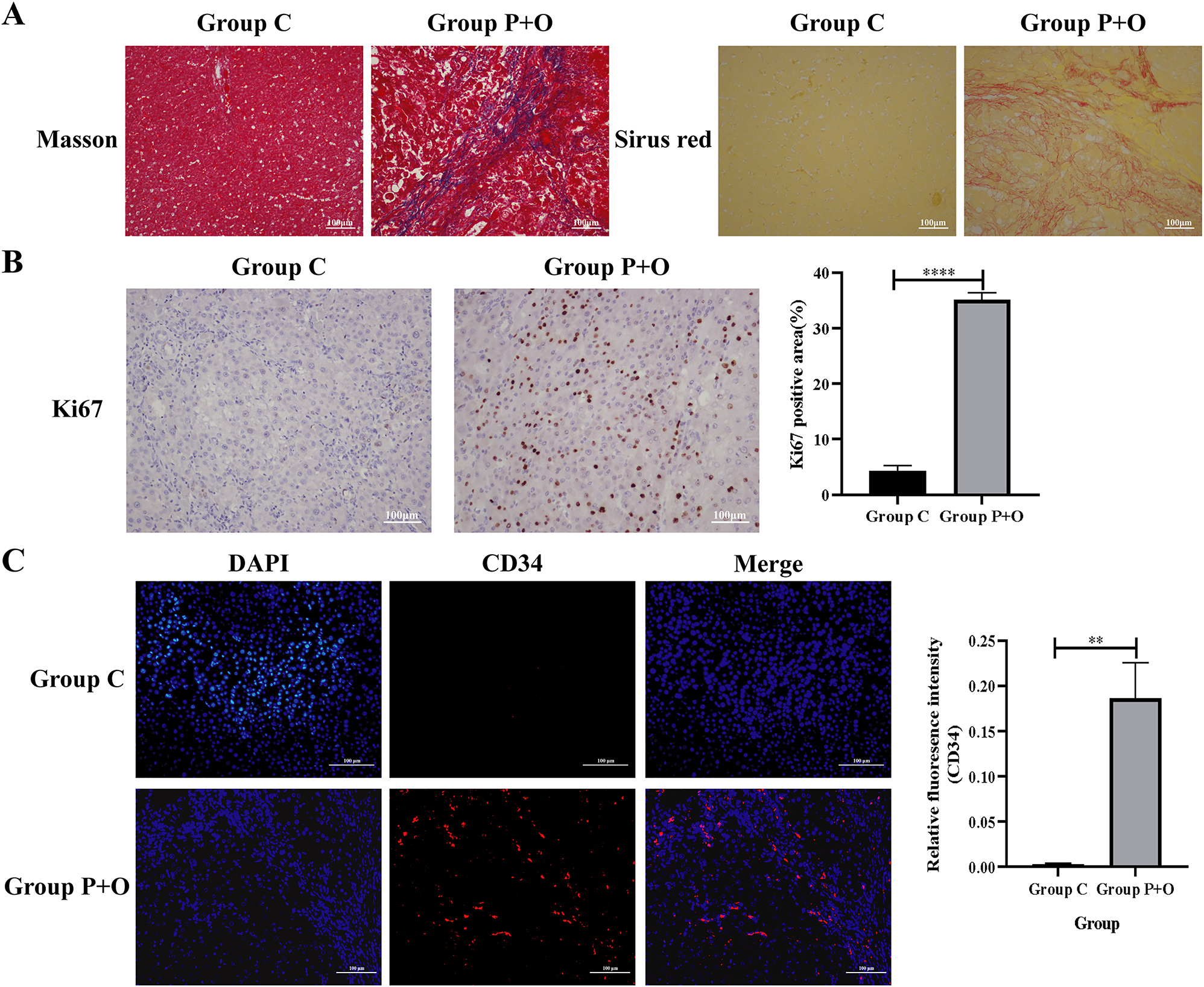 Establishment and refinement of a DEN-induced hepatocellular carcinoma ...