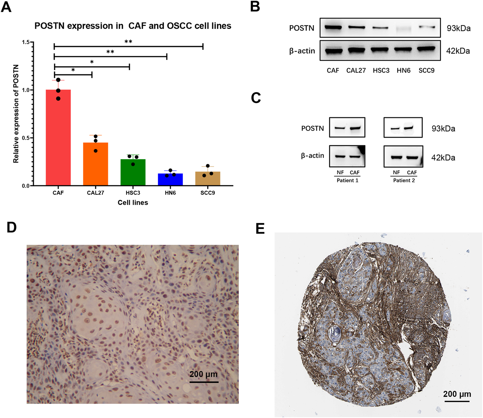 Integrated analyses reveal prognostic markers associated with cancer ...