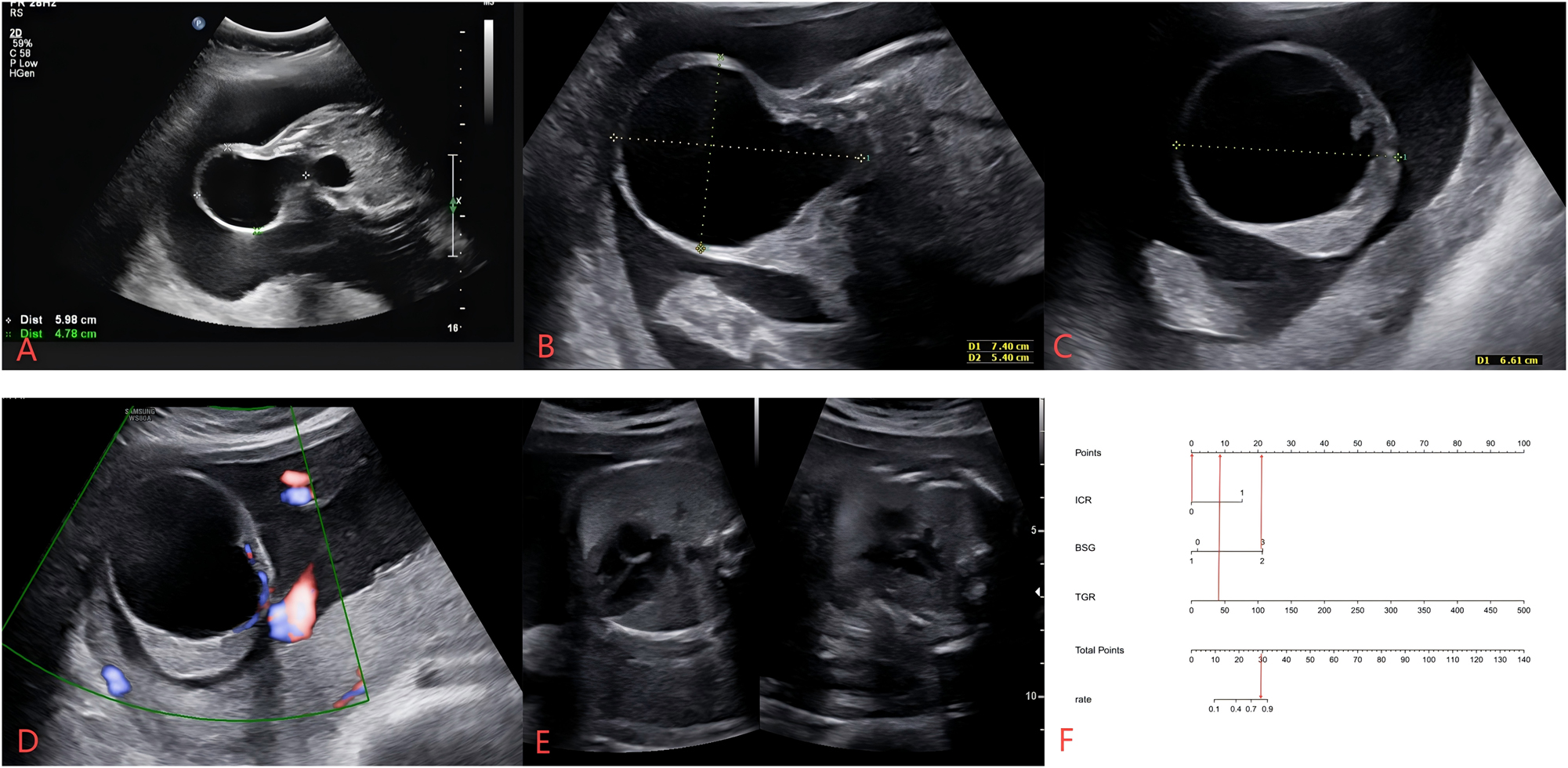 Ultrasound feature-based predictive model for prognostic assessment and ...