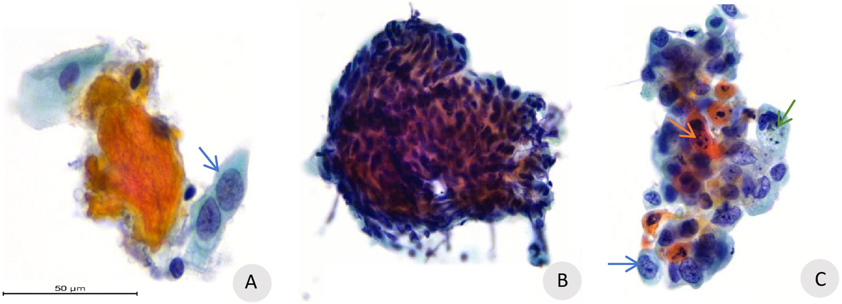The dual role of cytopathology in head and neck squamous cell carcinoma ...