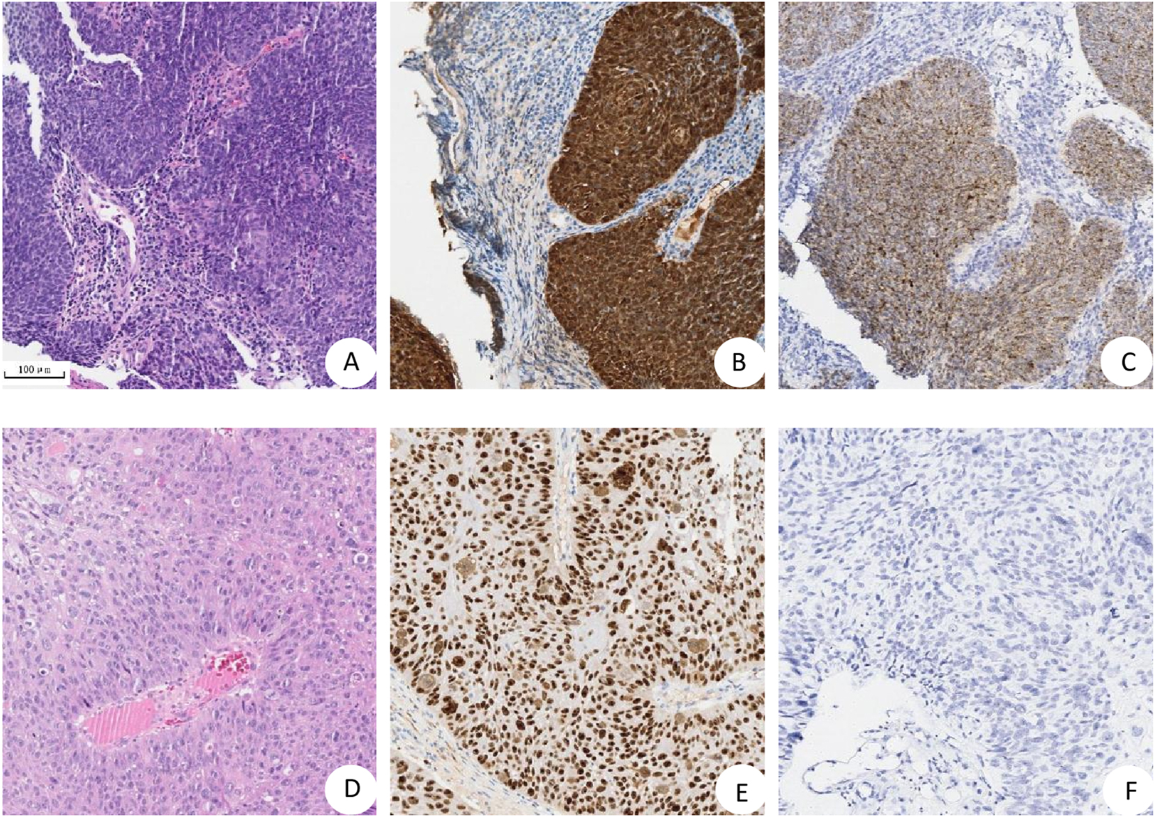 The dual role of cytopathology in head and neck squamous cell carcinoma ...