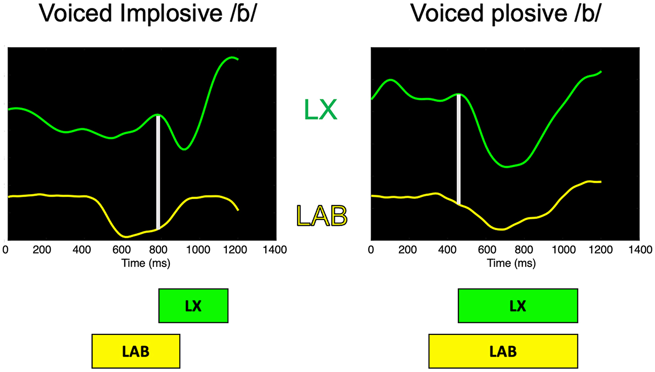 Vertical larynx actions and intergestural timing stability in Hausa ...