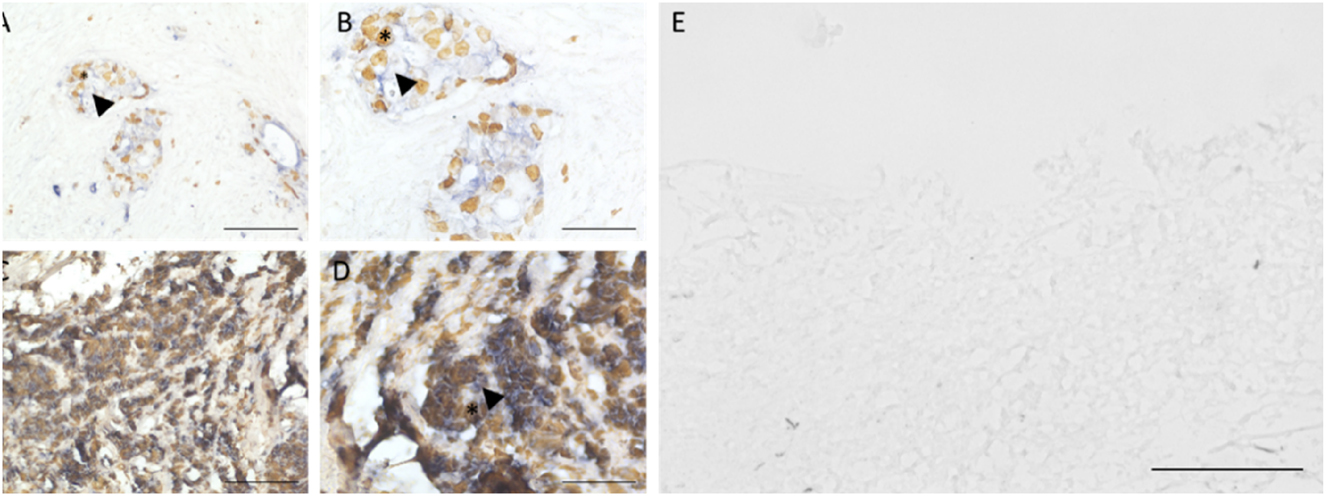 Patient-specific 3D-tissue slices from peritoneal metastases – An in ...