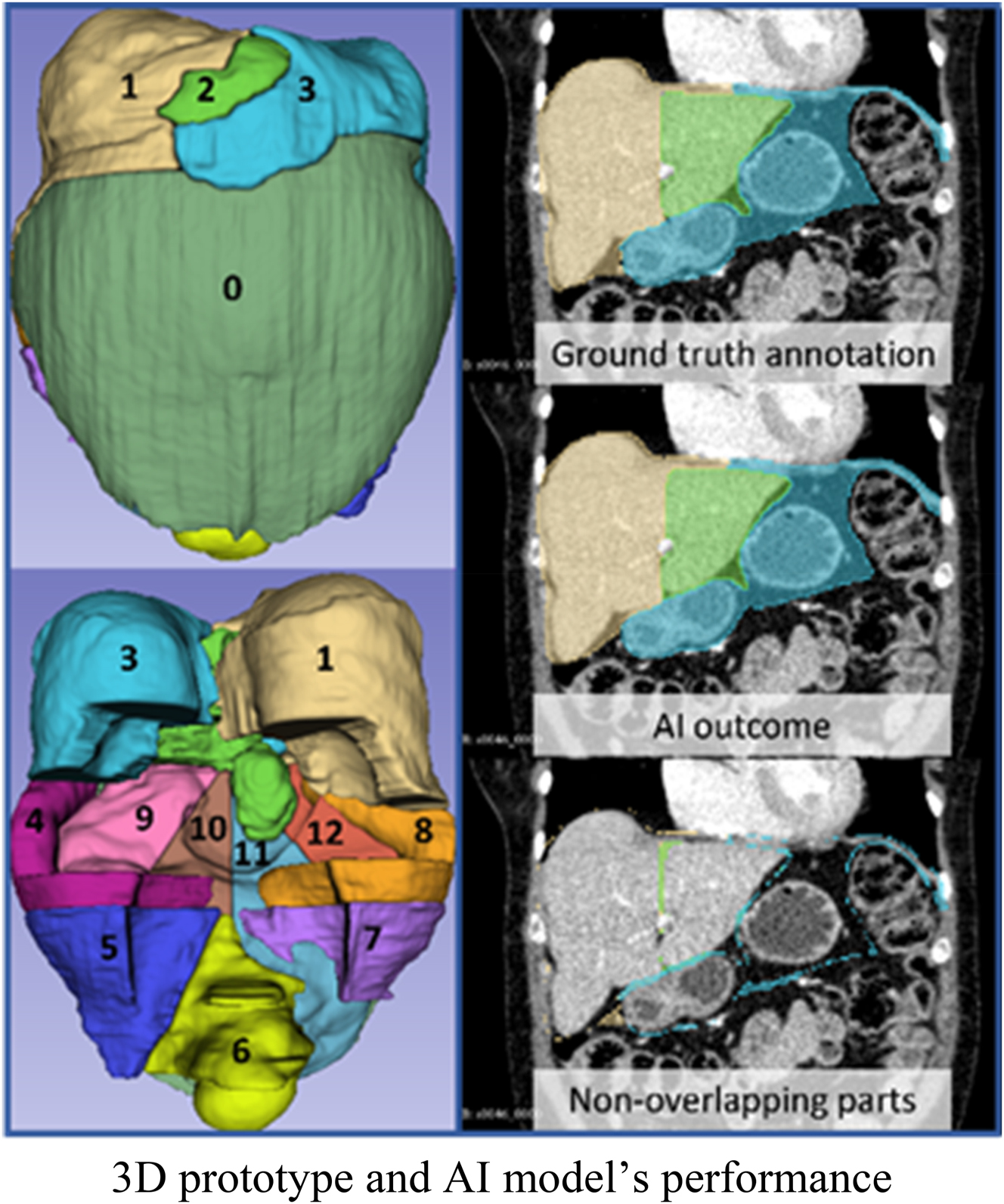 14th PSOGI-ISSPP International congress on Peritoneal Surface Malignancies*