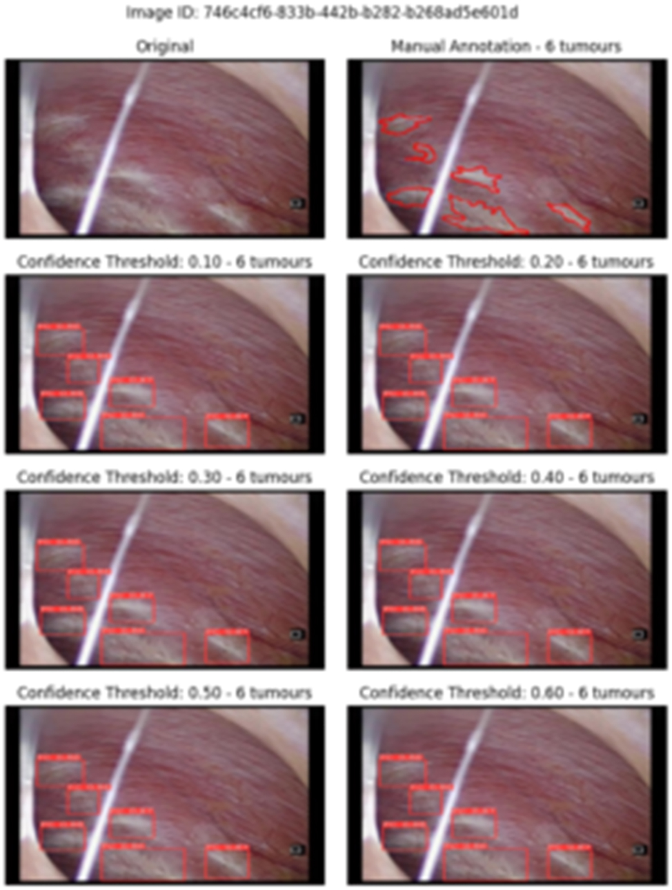14th PSOGI-ISSPP International congress on Peritoneal Surface Malignancies*