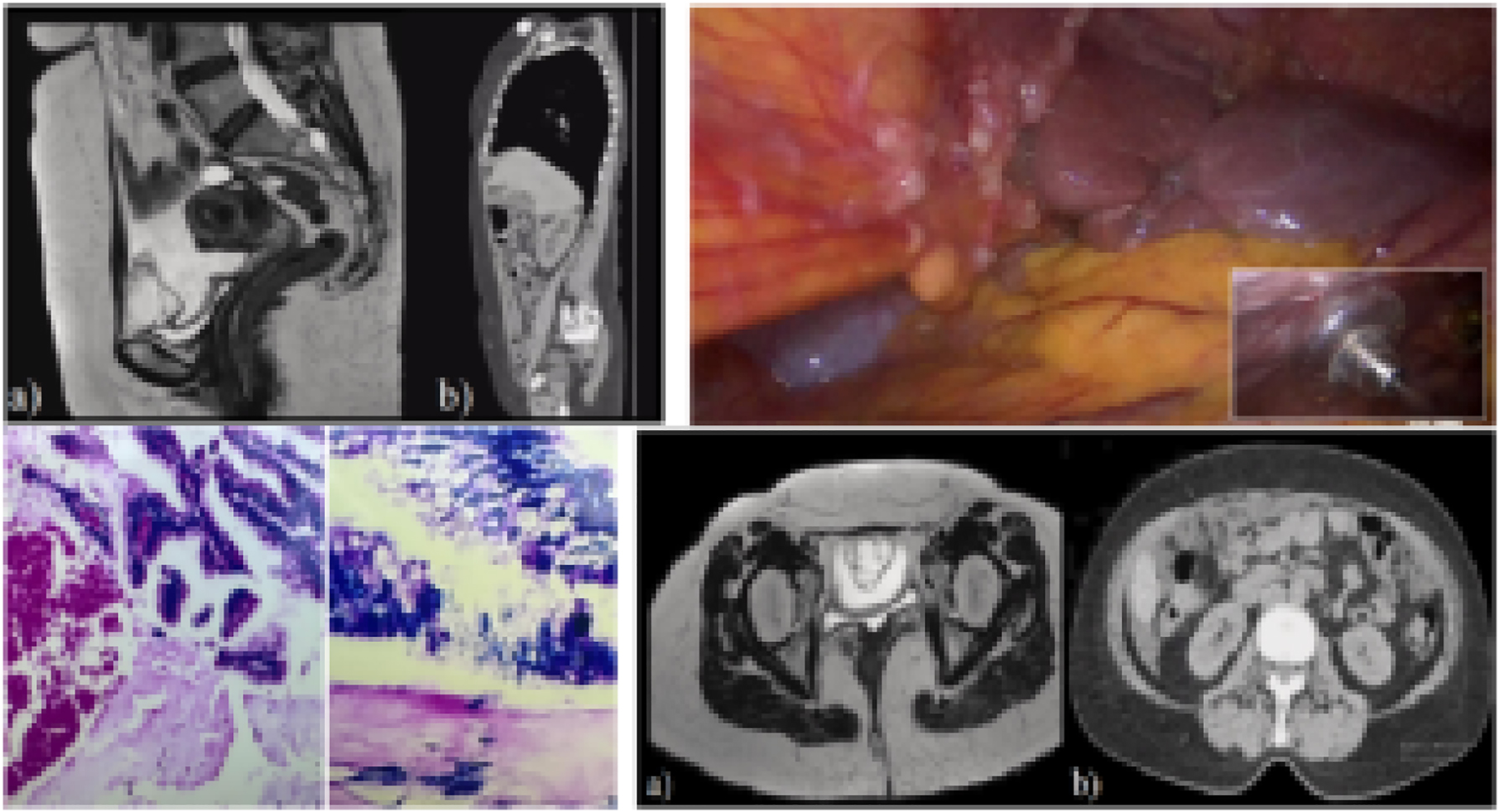 14th PSOGI-ISSPP International congress on Peritoneal Surface Malignancies*