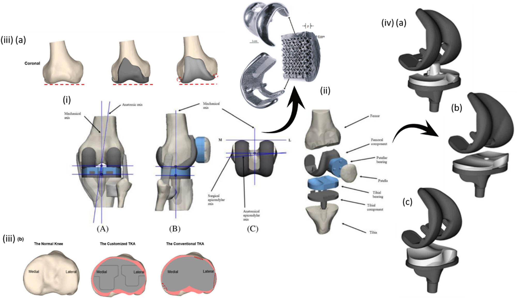 Advancement of additive manufacturing technology in the development of ...