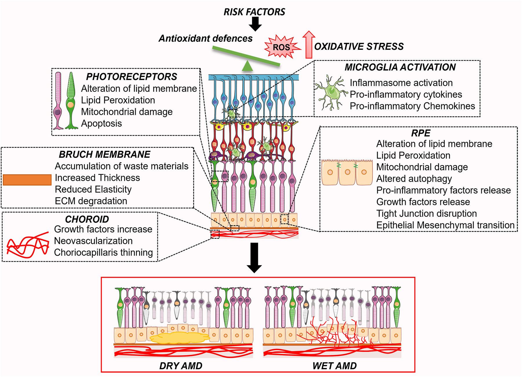 An overview of retinal light damage models for preclinical studies on ...