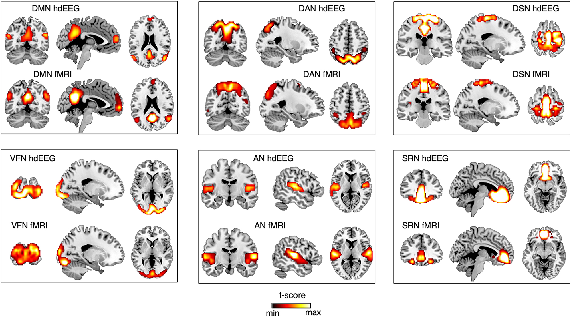 Resting-state brain dynamics: insights from oscillatory activity in ...