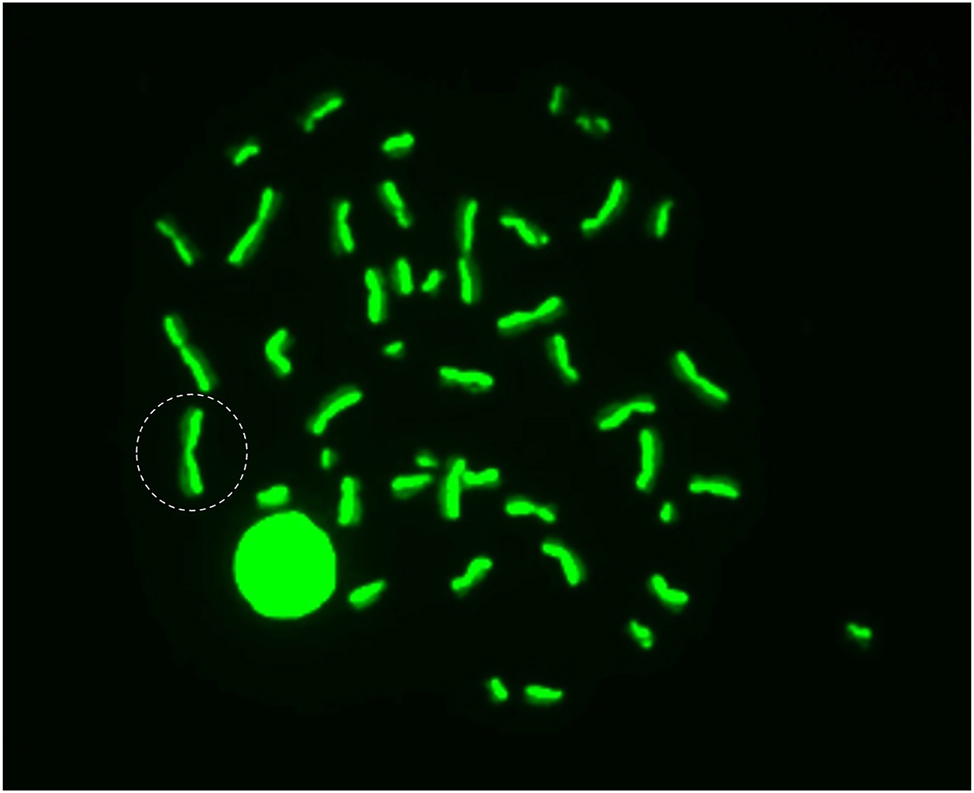 Chromosomal breakage and sister chromatid exchange analysis in breast ...