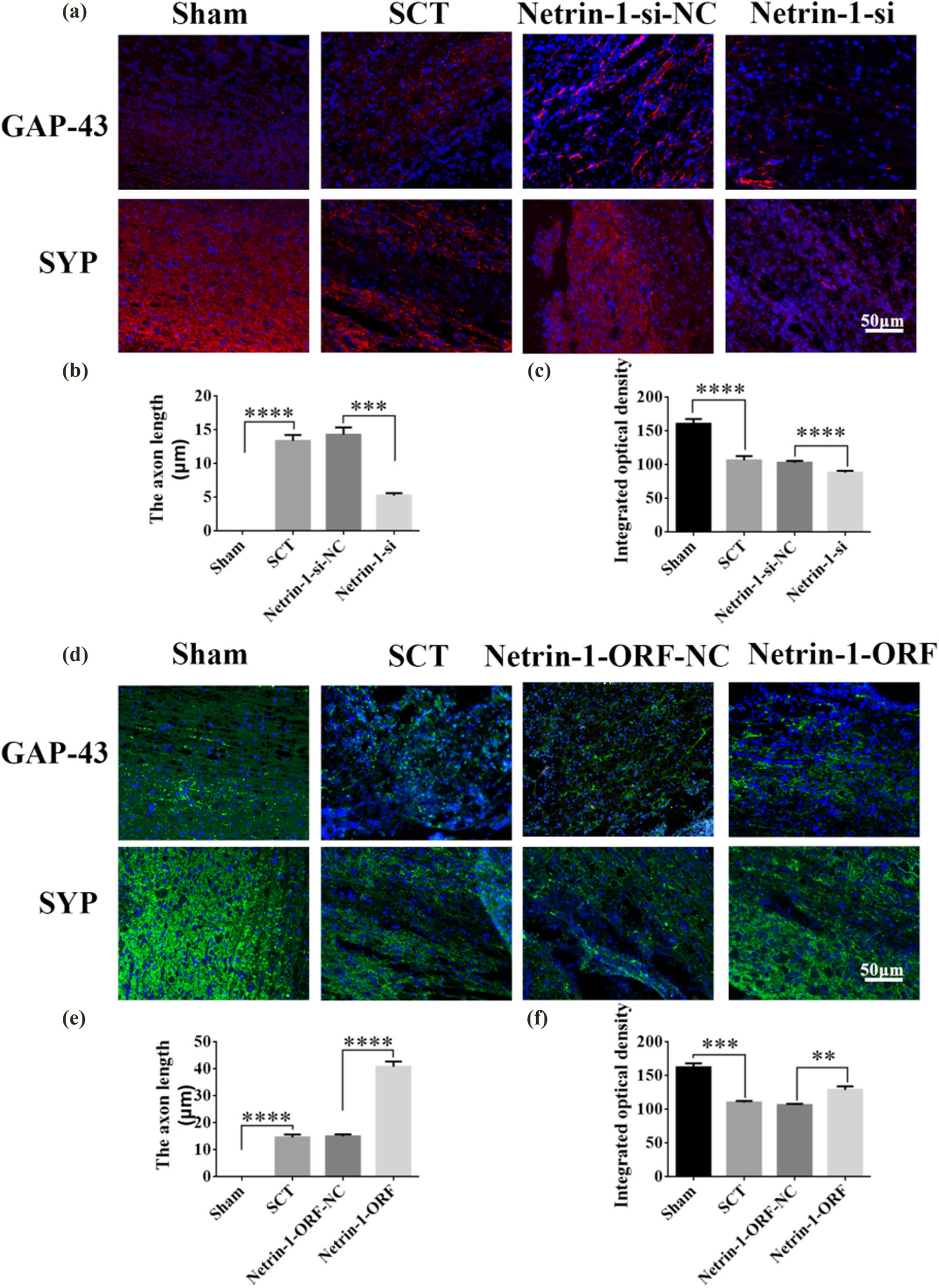 Lentivirus-mediated overexpression of netrin-1/DCC co-expression ...