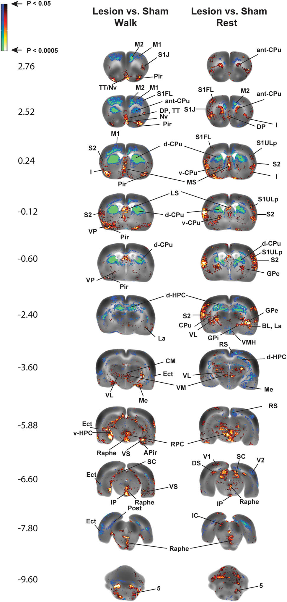 Functional remapping in networks of the Parkinsonian brain: A ...
