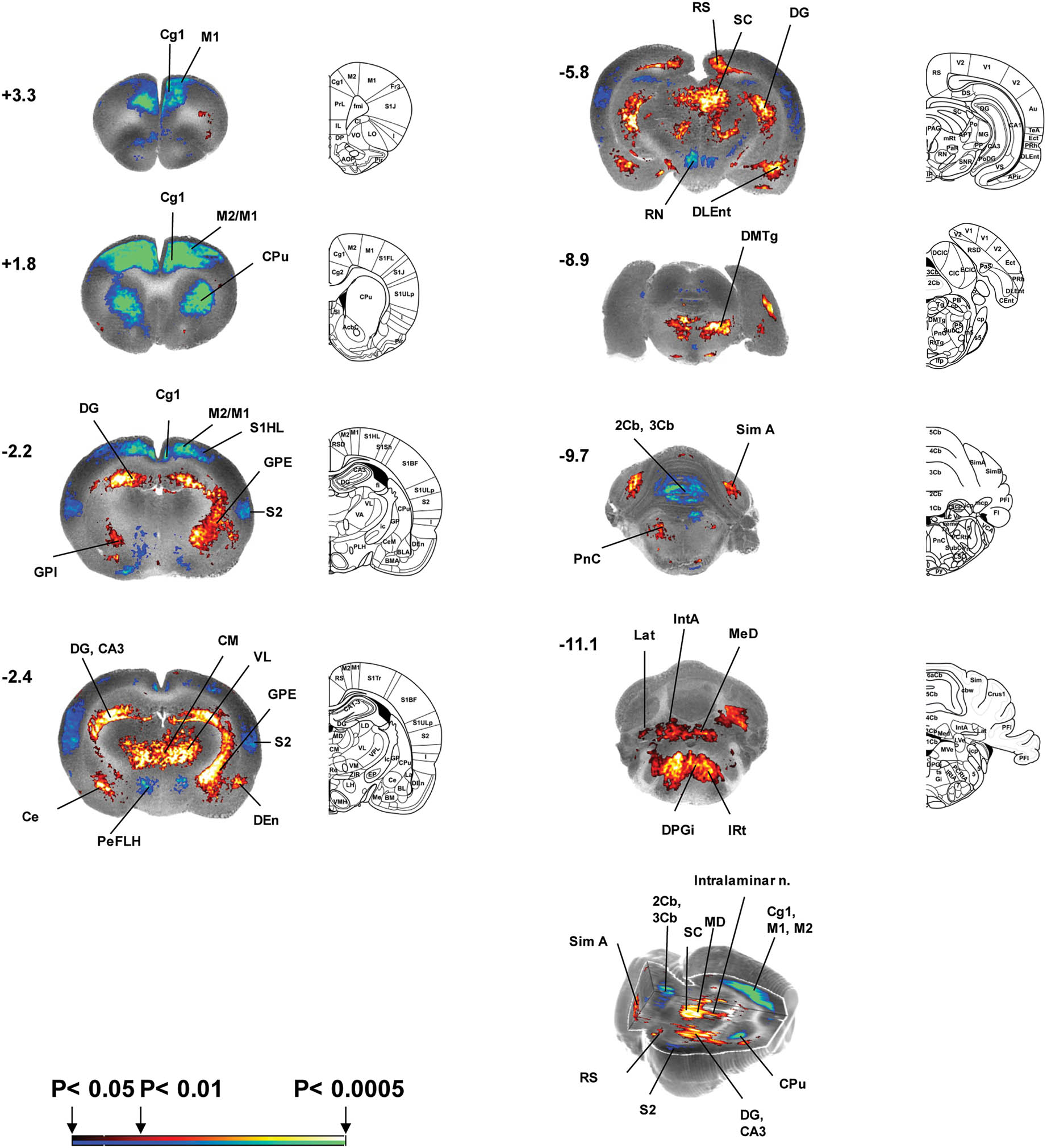 Functional remapping in networks of the Parkinsonian brain: A ...