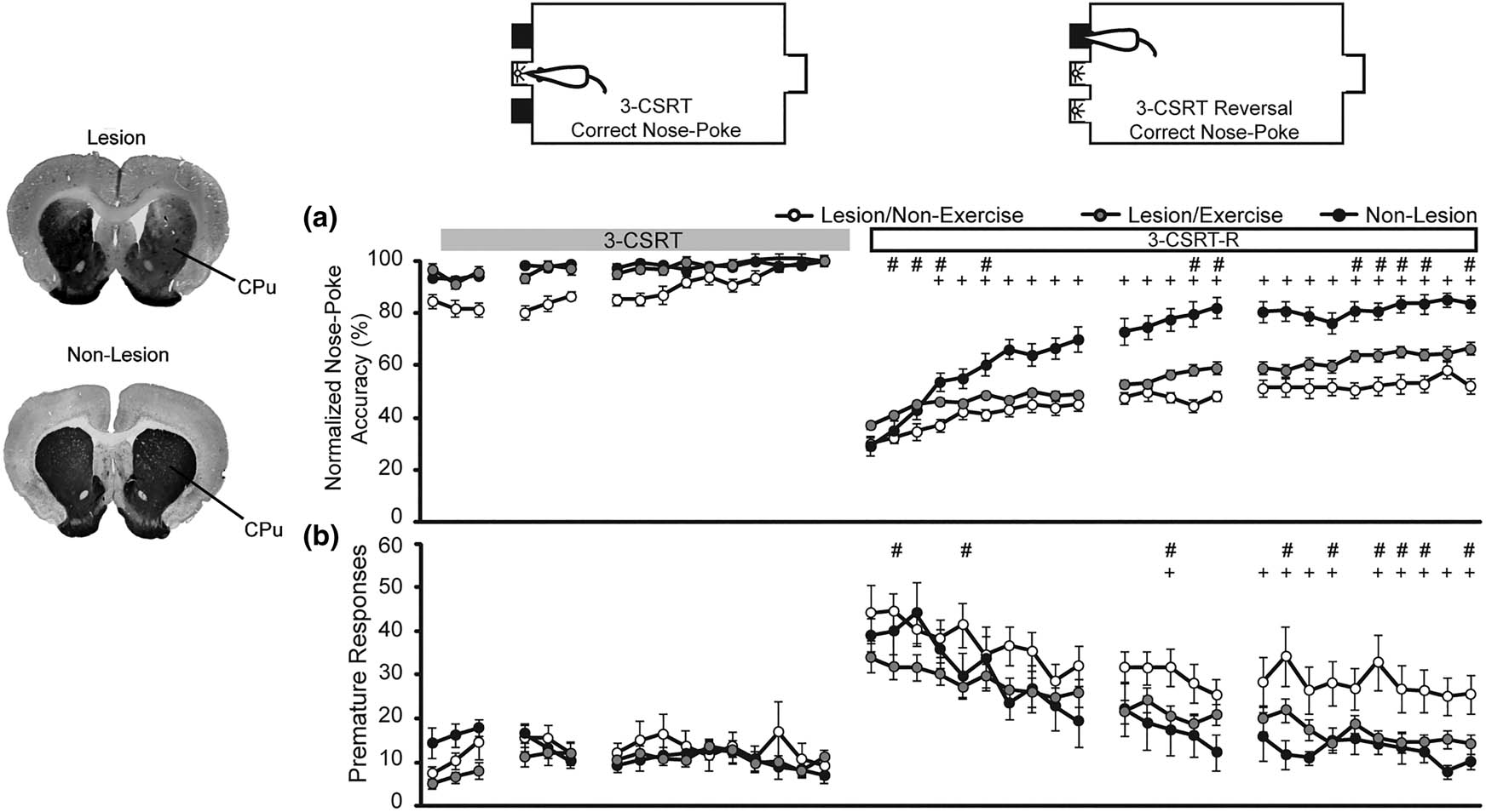 Functional remapping in networks of the Parkinsonian brain: A ...