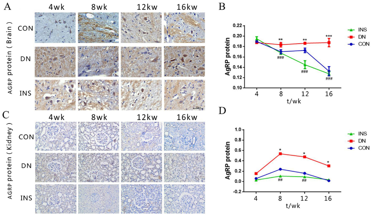 The expression of POMC and AgRP in brain and kidney tissu...
