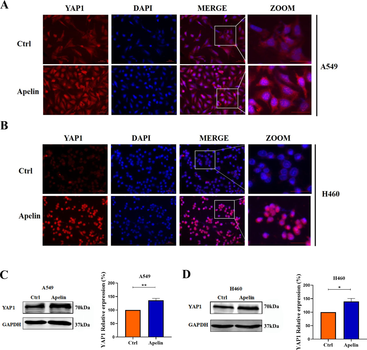 Apelin aggravates the migration and invasion of non-small...