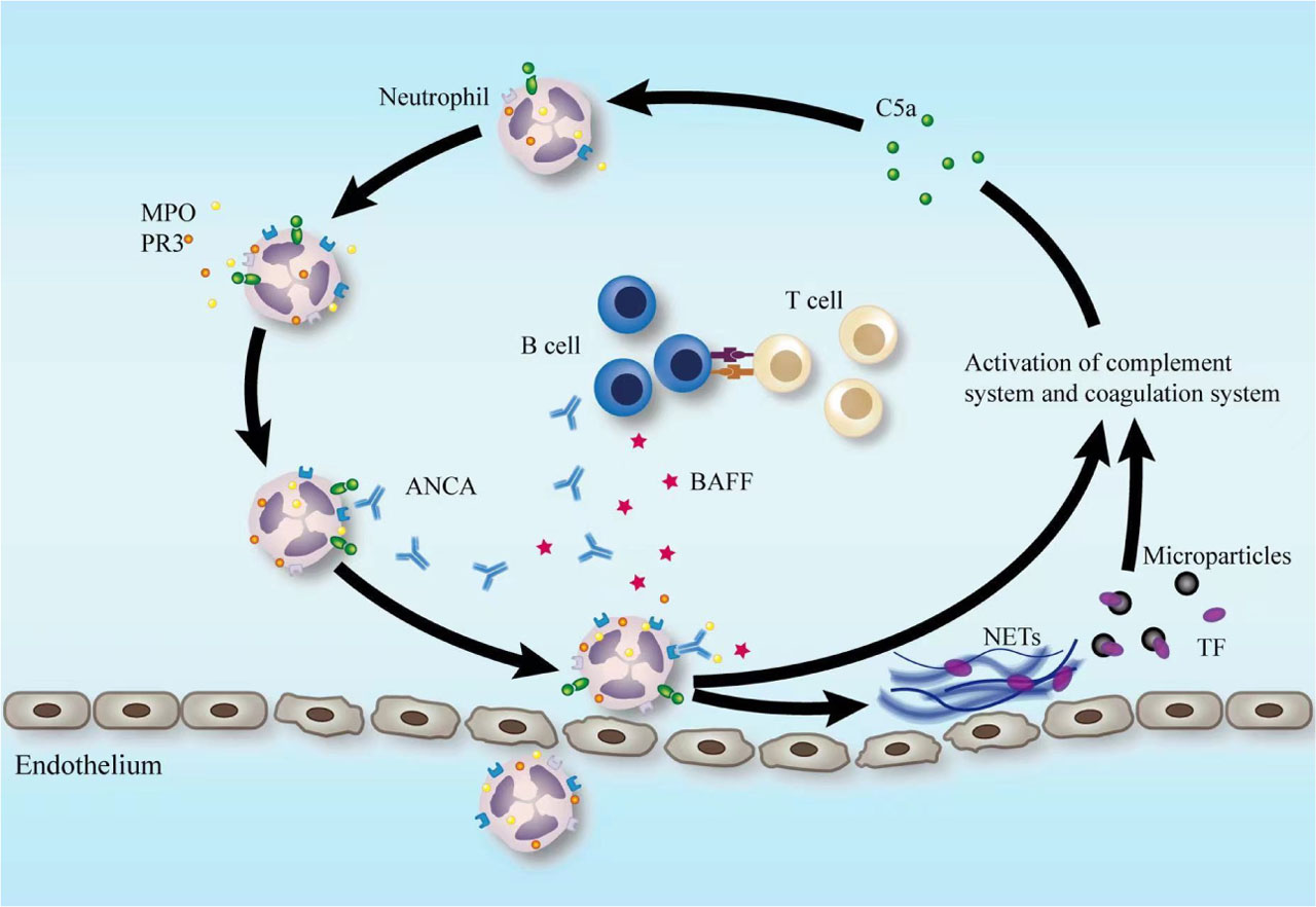 Pathogenesis of anti-neutrophil cytoplasmic antibody-associated vasculitis