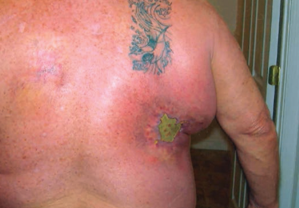 Management of Ionizing Radiation Injuries and Illnesses,